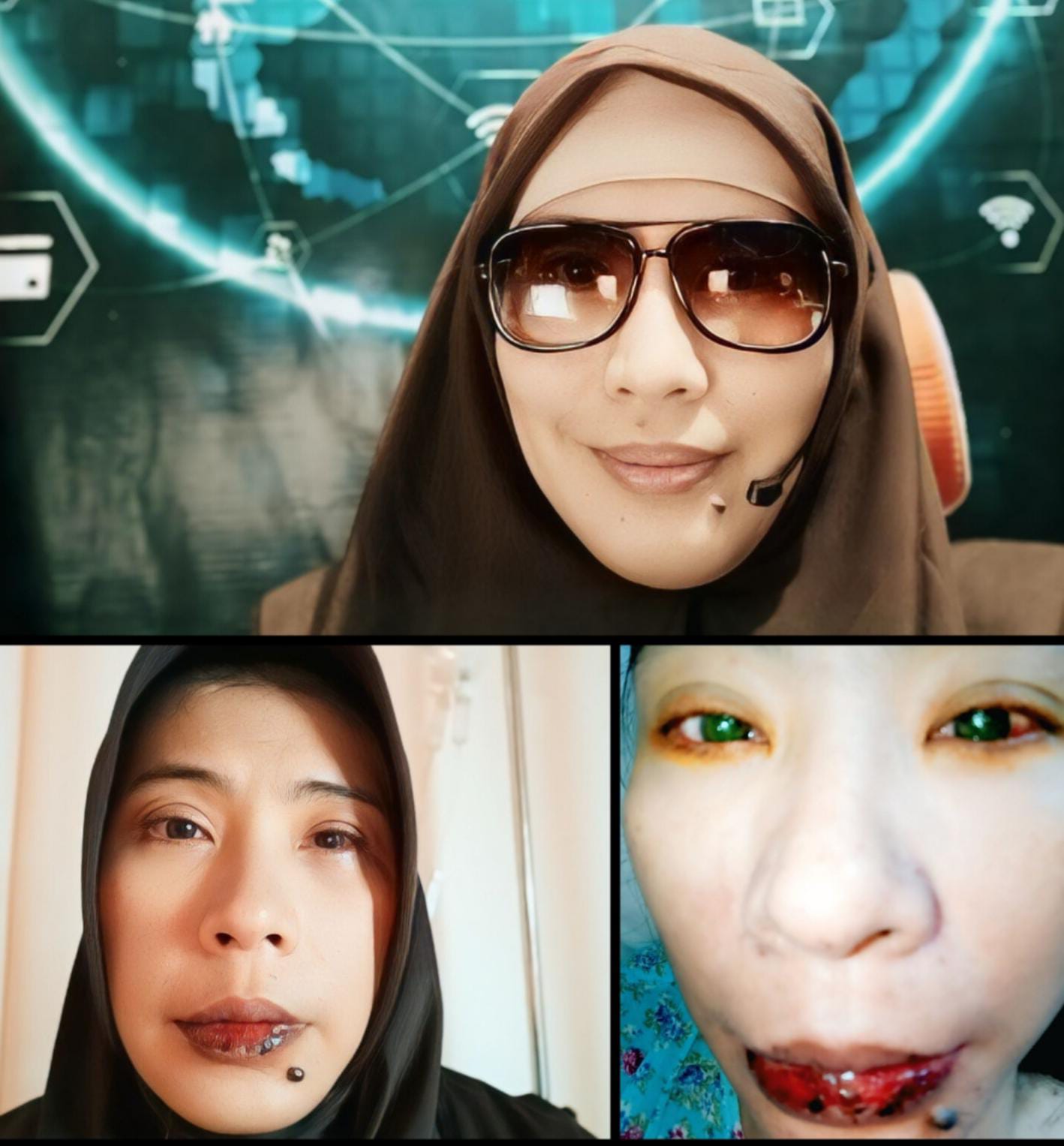 SJS: Ketika Obat Jadi Bencana! - Metrum